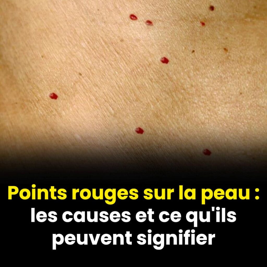11 causes méconnues derrière ces éruptions cutanées rouges - Santé ...
