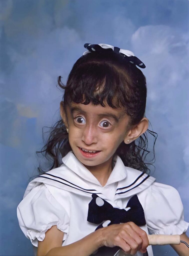 La transformation incroyable d'une femme autrefois moquée pour son ...