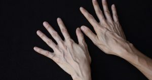 Veines apparentes : quand faut-il s’en inquiéter et comment en prendre ...