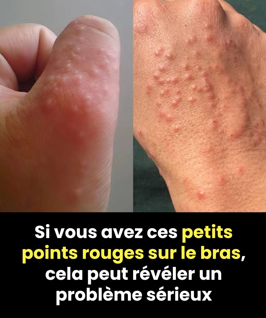 Ces petites taches rouges sur votre peau : faut-il s’inquiéter ...
